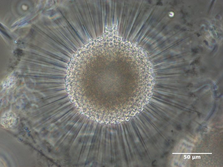 MOBYDICK – Rhizaria – MIO Plankton images