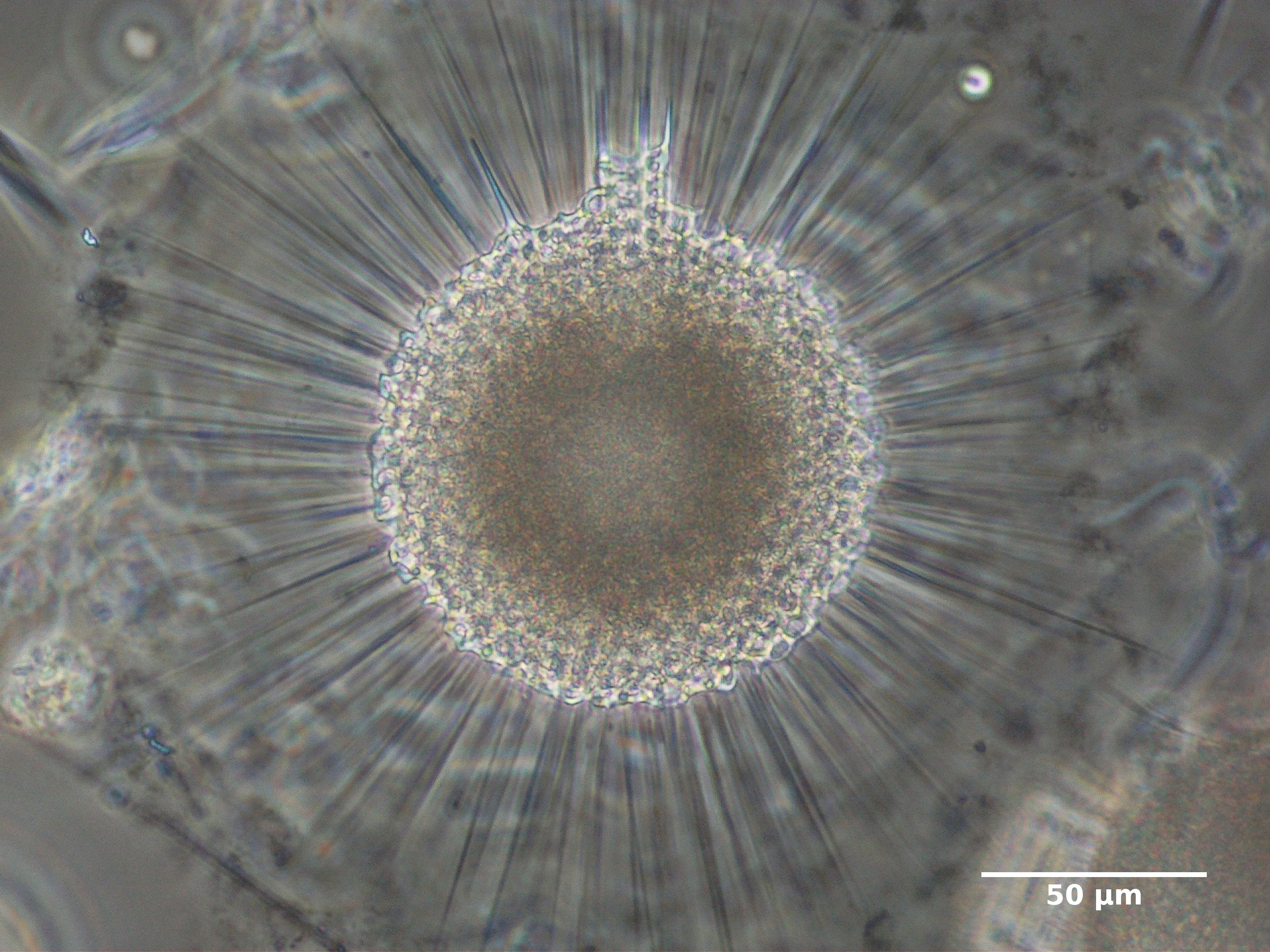 MOBYDICK – Rhizaria – MIO Plankton images