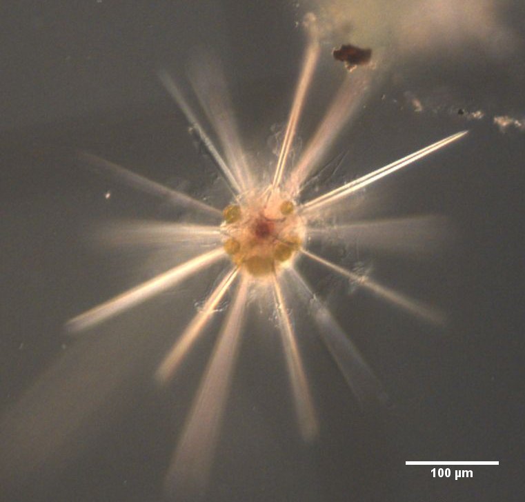 OUTPACE – Rhizaria – MIO Plankton images