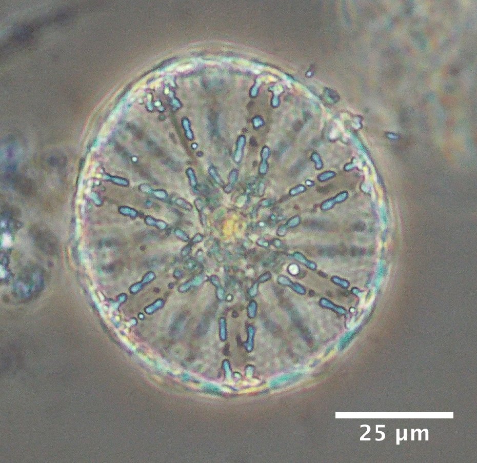 OUTPACE – Diatoms – MIO Plankton images