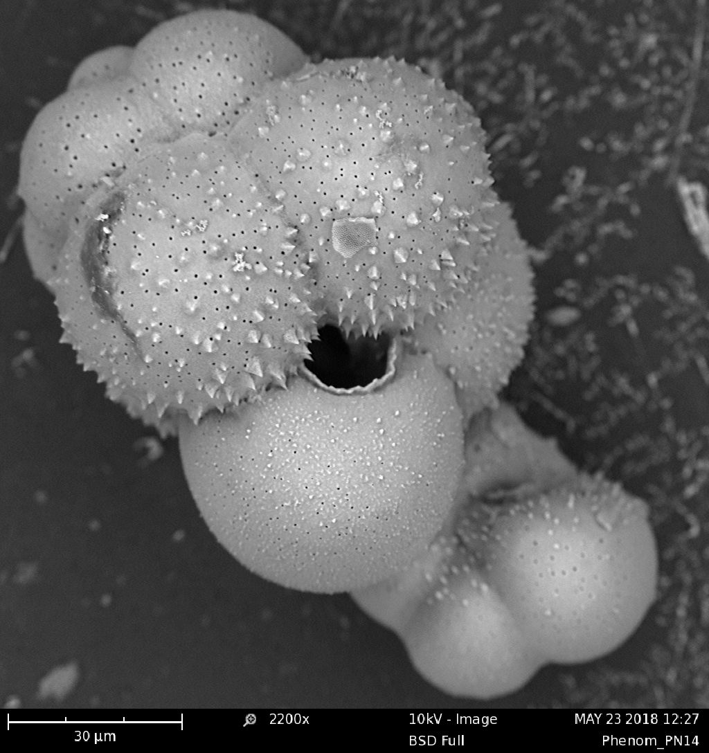 MOBYDICK – Rhizaria – Foraminifera – MIO Plankton images