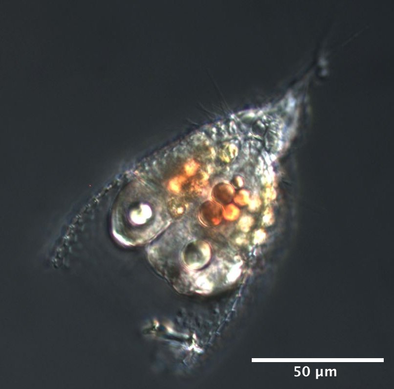 OUTPACE – Rhizaria – MIO Plankton images