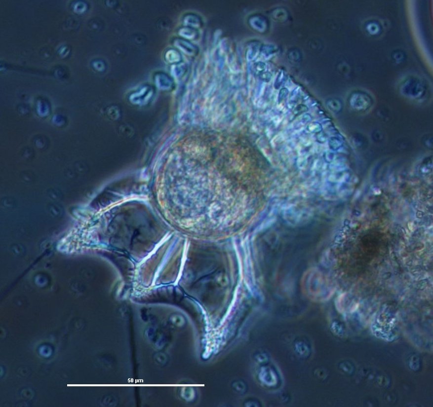 Ornithocercus magnificus_03 – MIO Plankton images