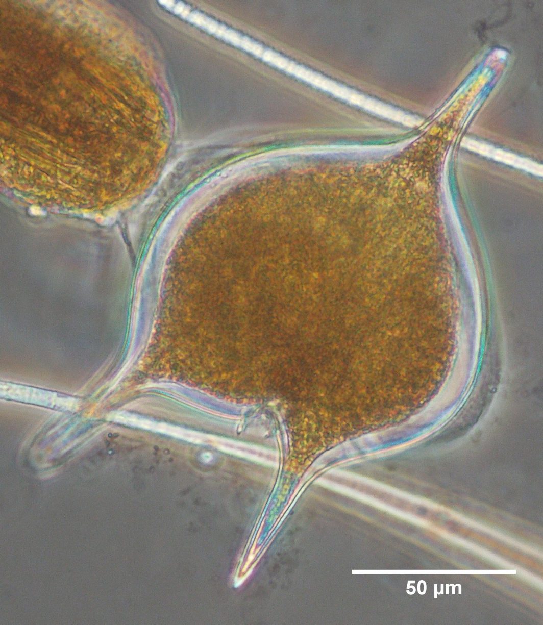 OUTPACE – Other microplankton – MIO Plankton images