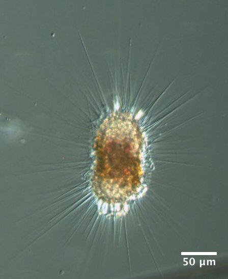 OUTPACE – Rhizaria – MIO Plankton images