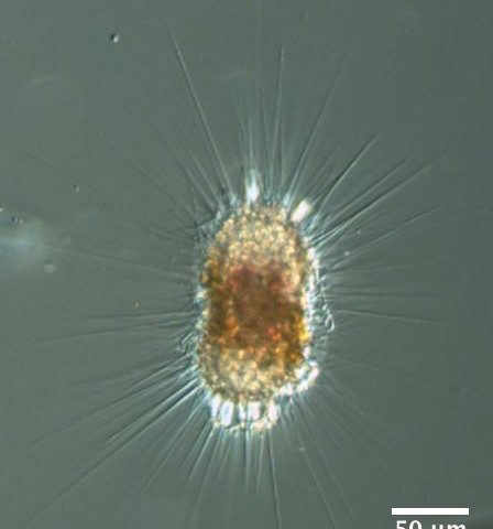 OUTPACE – Spumellaria – MIO Plankton images