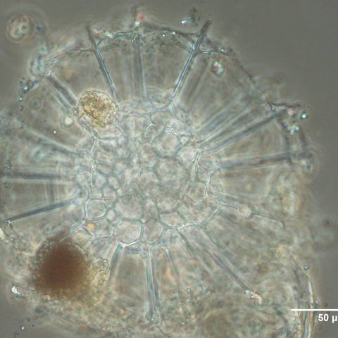OUTPACE – Spumellaria – MIO Plankton images