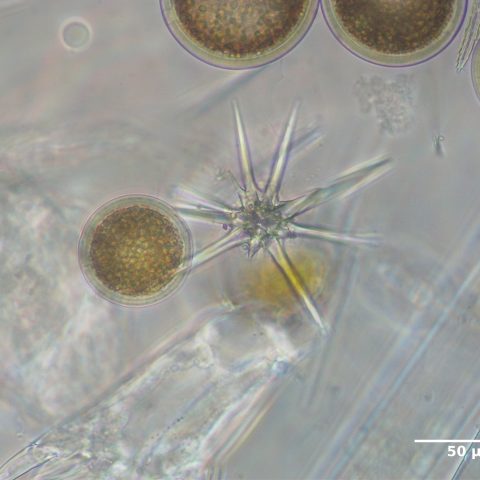 MOBYDICK – Rhizaria – Acantharia – MIO Plankton images
