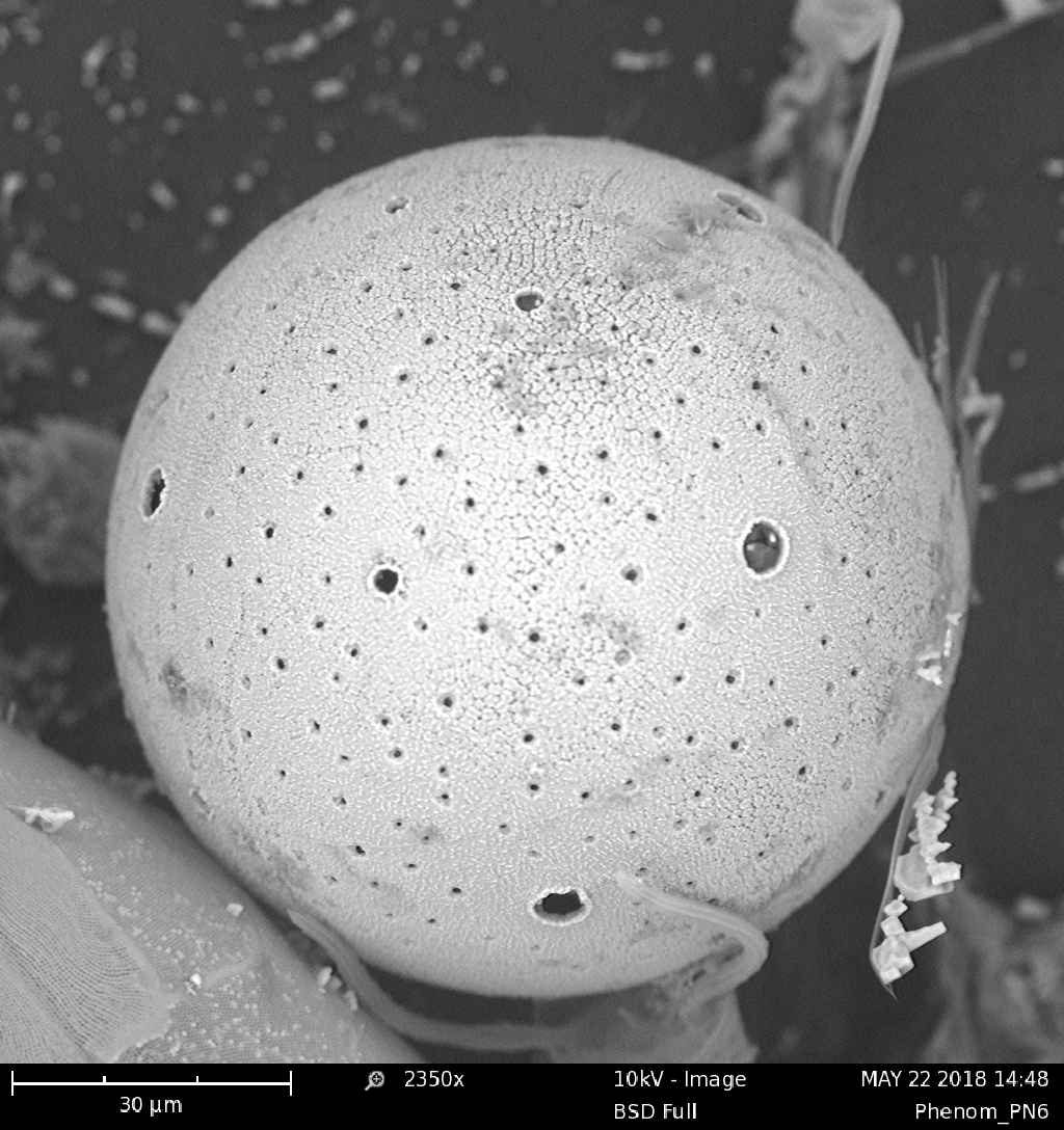 MOBYDICK – Rhizaria – Foraminifera – MIO Plankton images