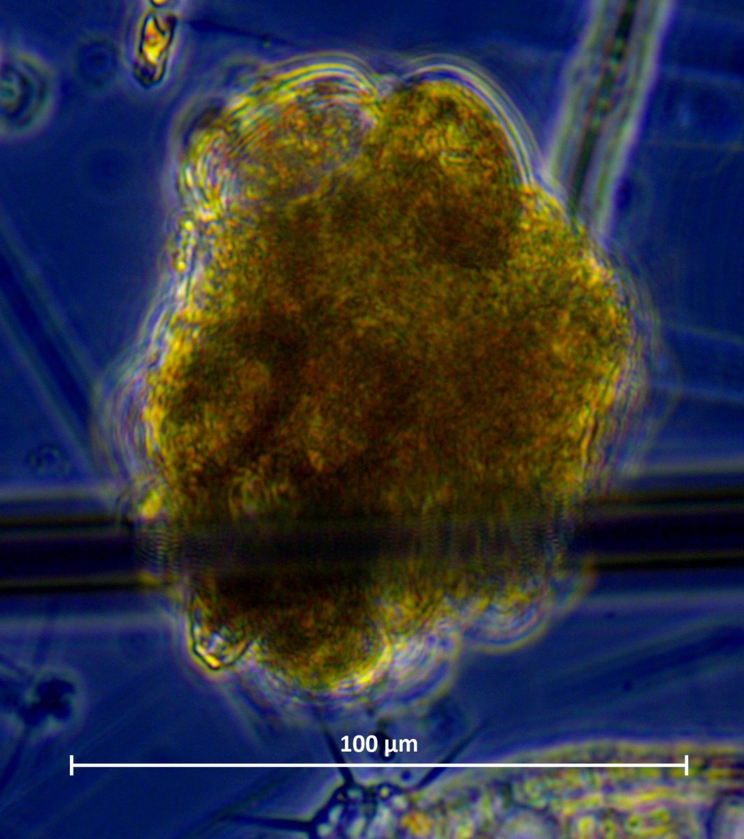 KEOPS II – Fecal pellets – MIO Plankton images