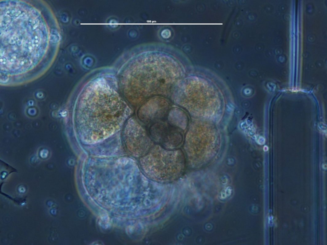 SOMLIT – Other microplankton – MIO Plankton images