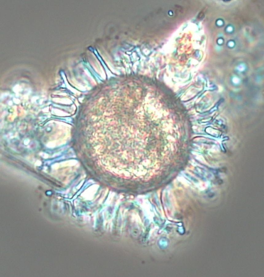 Spiniferites sp. – MIO Plankton images