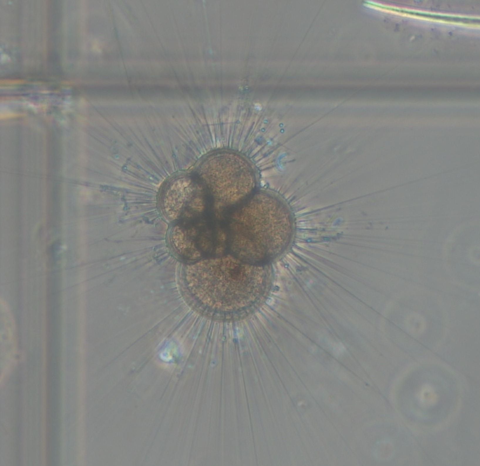 Foraminifera_03 – MIO Plankton images