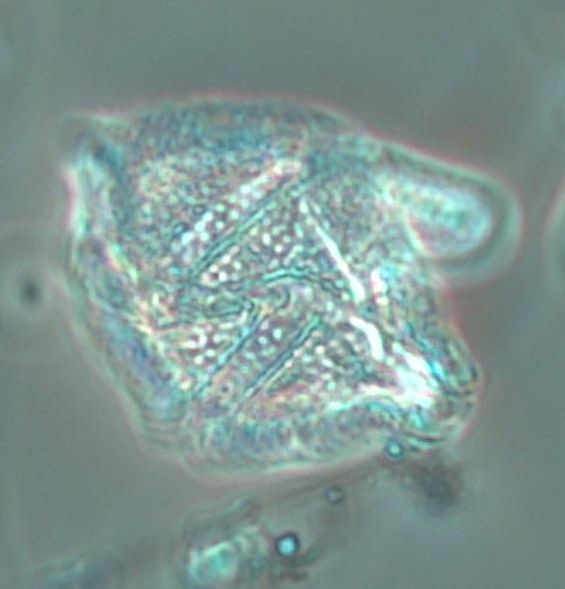 Gonyaulax spinifera_02 – MIO Plankton images