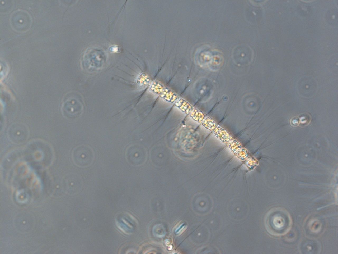 Bacteriastrum cf elongatum x20_no scale – MIO Plankton images