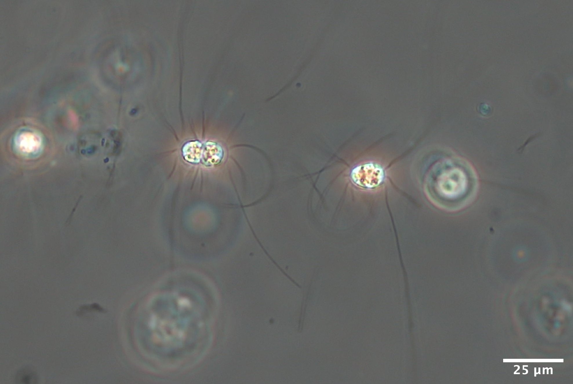 Bacteriastrum jadranum-juin-2022 – MIO Plankton images