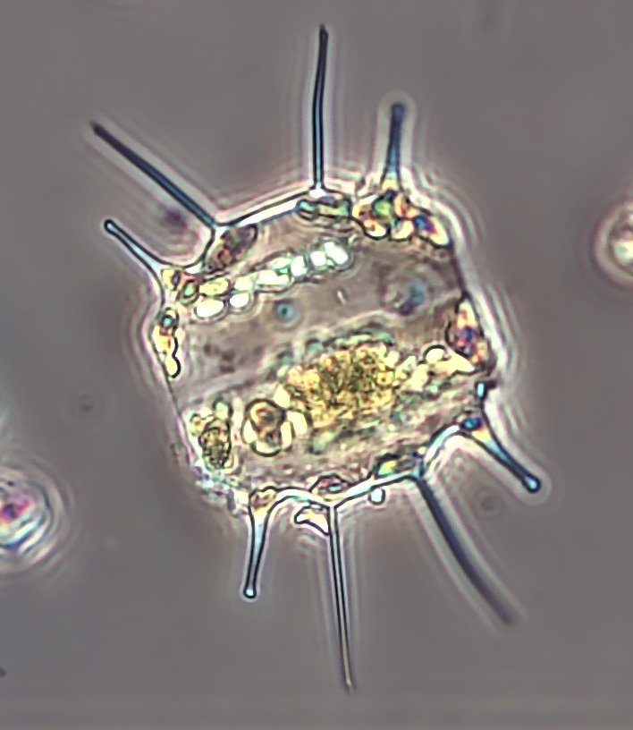 Odontella (Trieres) mobiliensis – MIO Plankton images