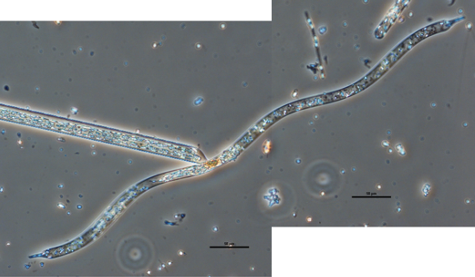 Proboscia alata_weird – MIO Plankton images
