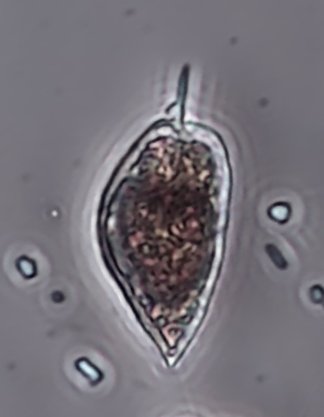Prorocentrum micans – MIO Plankton images