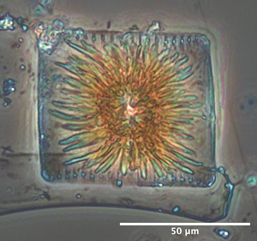 Striatella unipunctata-juin-2022 – MIO Plankton images