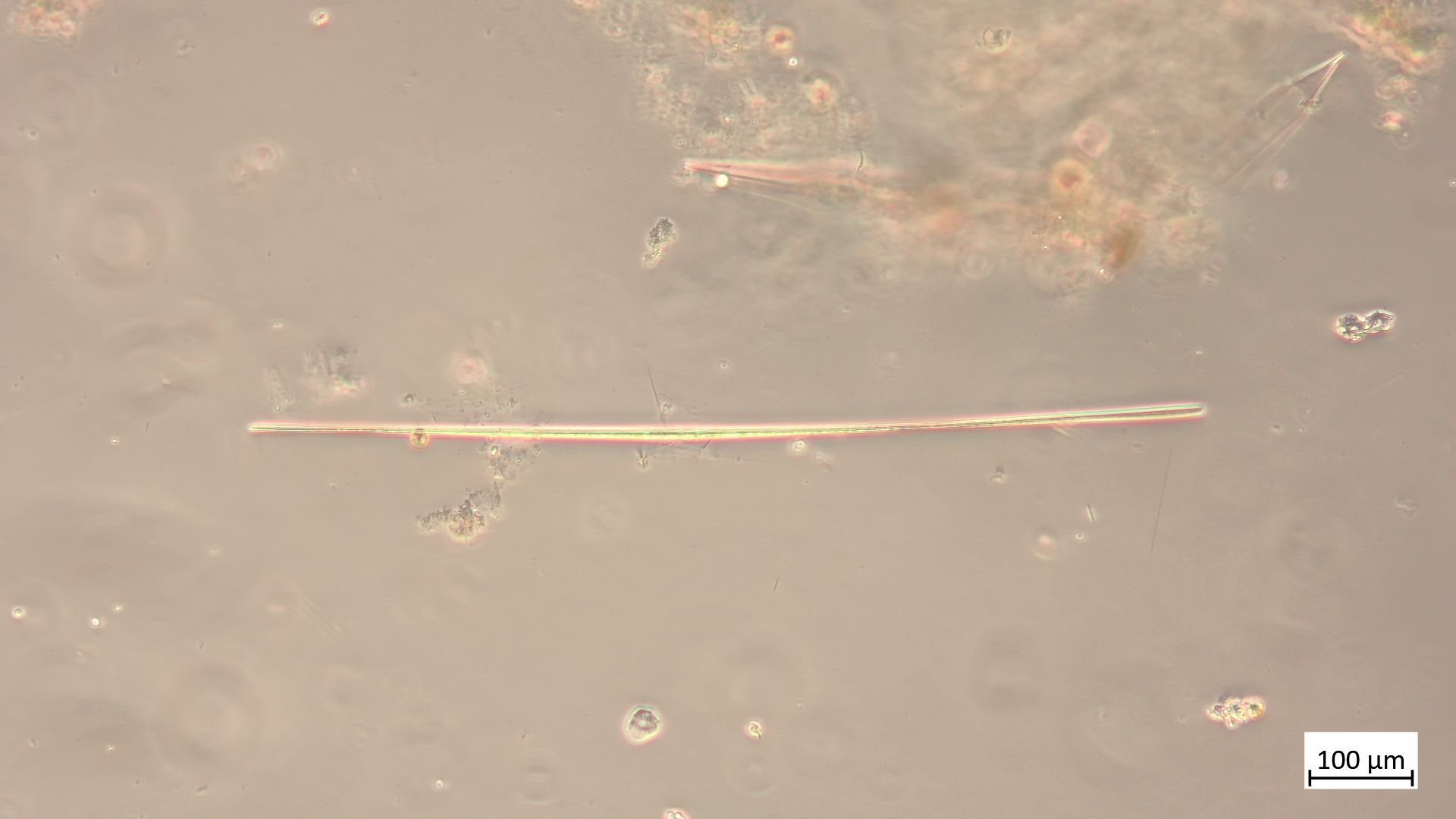 Thalassiothrix longissima – MIO Plankton images