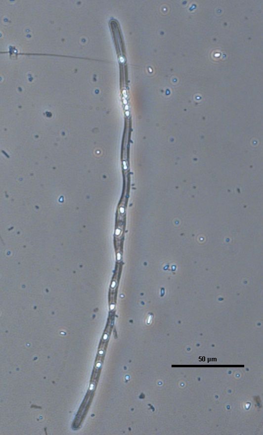 Toxarium undulatum – MIO Plankton images