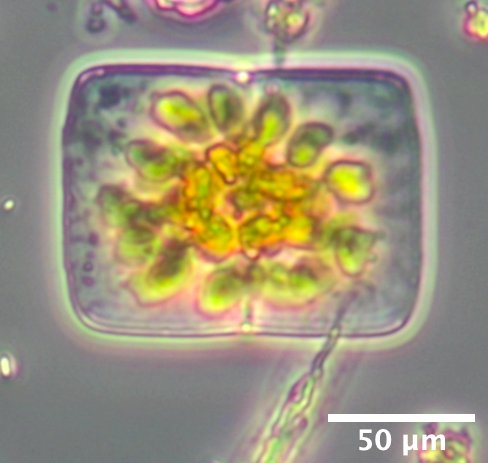 cf Striatella unipunctata-PN2 – MIO Plankton images